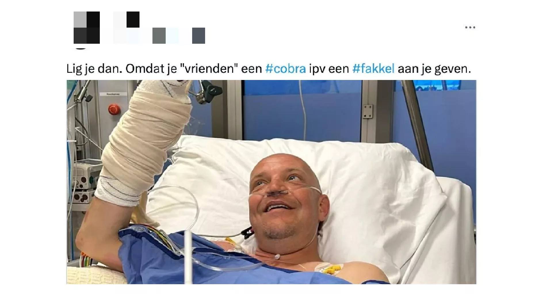 Foto: PSV-supporter die hand verloor door cobra: 'Vriend zei dat het ...