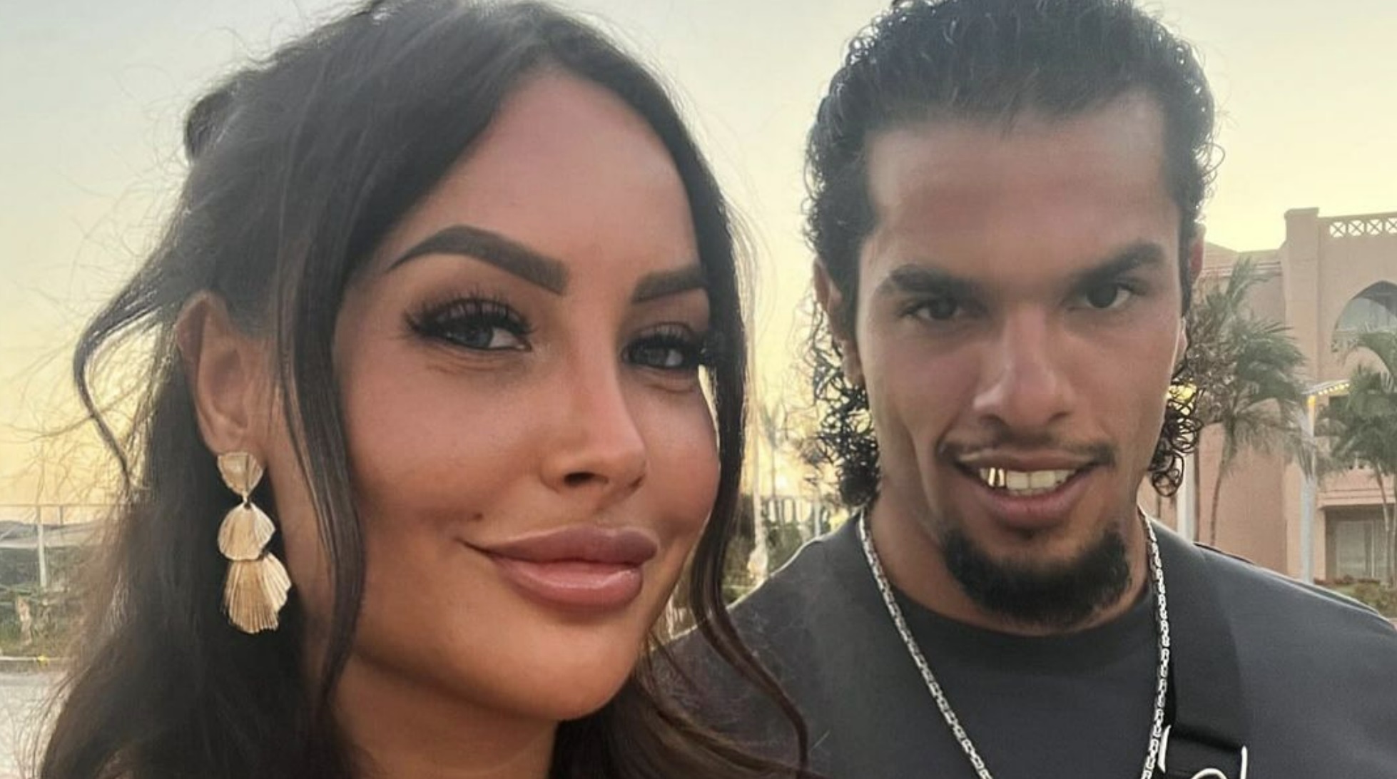 Bizar: Esmee Ipema uit Echte Meisjes in de Jungle heeft gezicht wéér laten verbouwen!