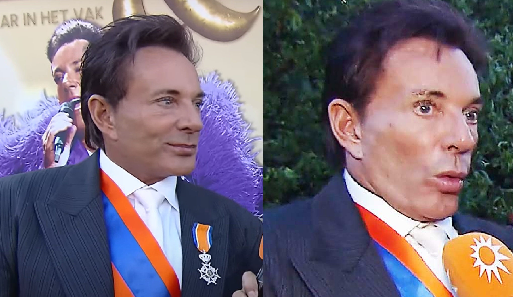 Geschrokken reacties door nieuw gezicht van Gerard Joling bij interview ...